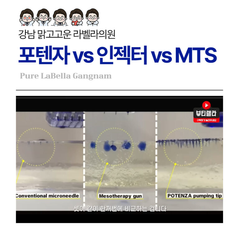 스킨부스터 포텐자 펌핑팁 Vs 인젝터 Vs Mts 비교 글 하나로 정리해드립니다 강남 신논현역 성형외과 피부과 맑고